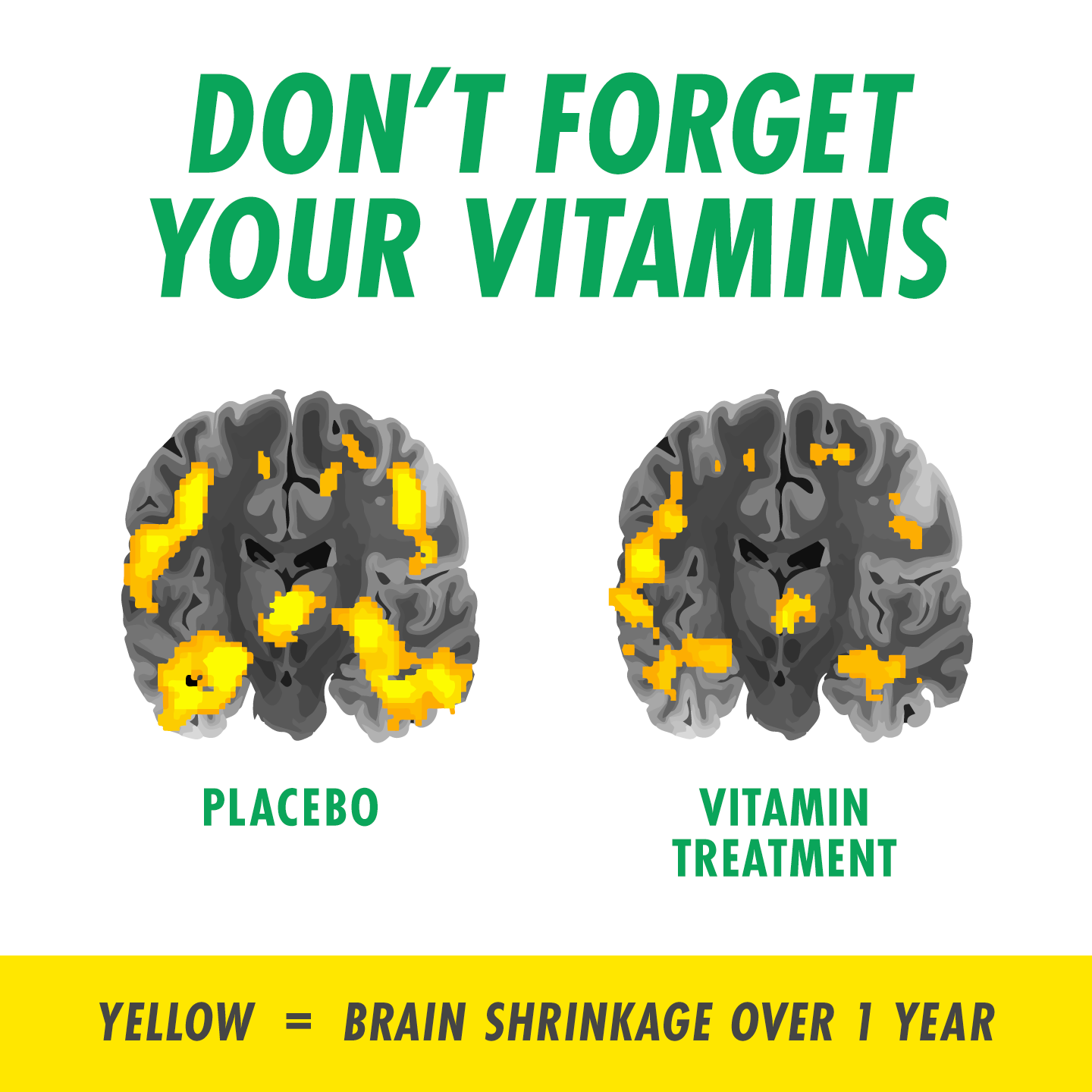 Don't forget your vitamins - Food for the Brain